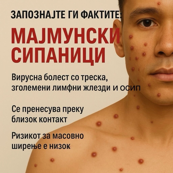 Мајмунски сипаници во Македонија епидемиологот Даниловски вели дека не се пренесуваат лесно и